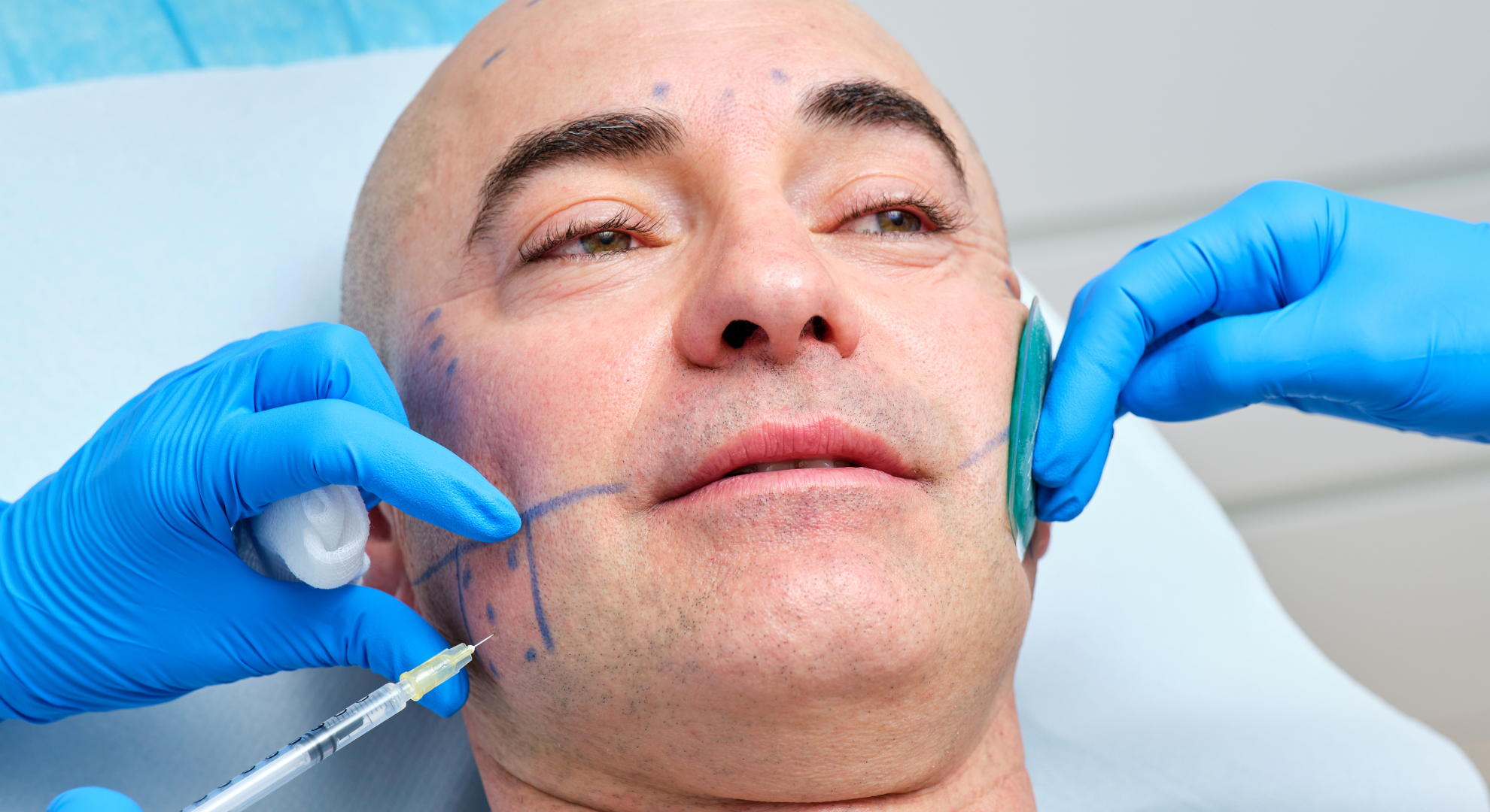 Neurotoxin Master Level 1 – Global Medical Aesthetic Academy of Canada